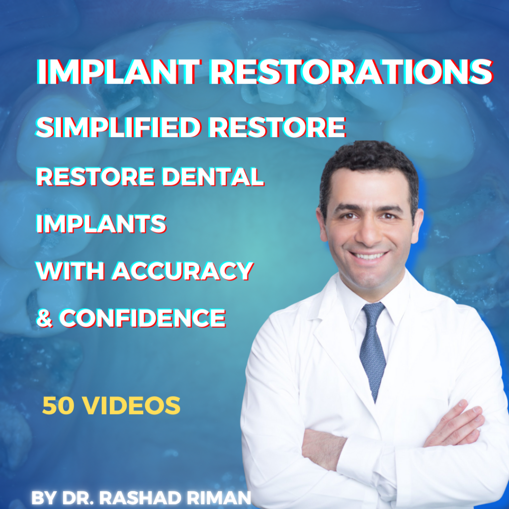 Implant Restorations Simplified Restore Dental Implants With Accuracy ...